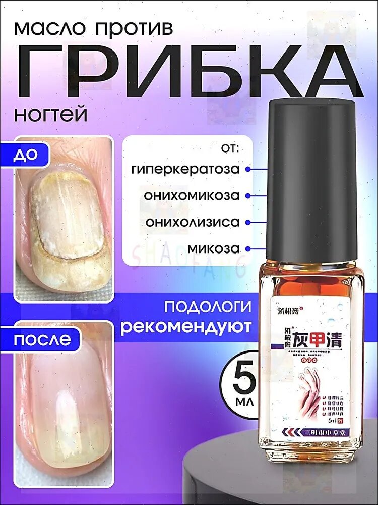 Масло для ногтей от грибка, средство для лечения грибка Novo, 5 мл, лечение онихолизиса