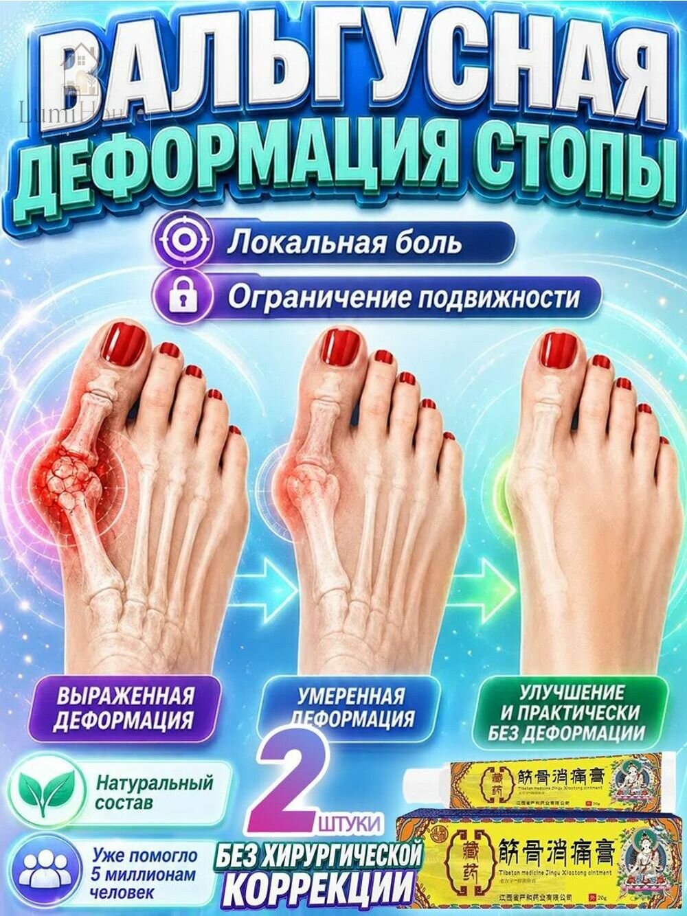 2 штуки, мазь от косточки на большом пальце, тайская от подагры мазь, монастырская от шишки лечение косточки подагры шишки