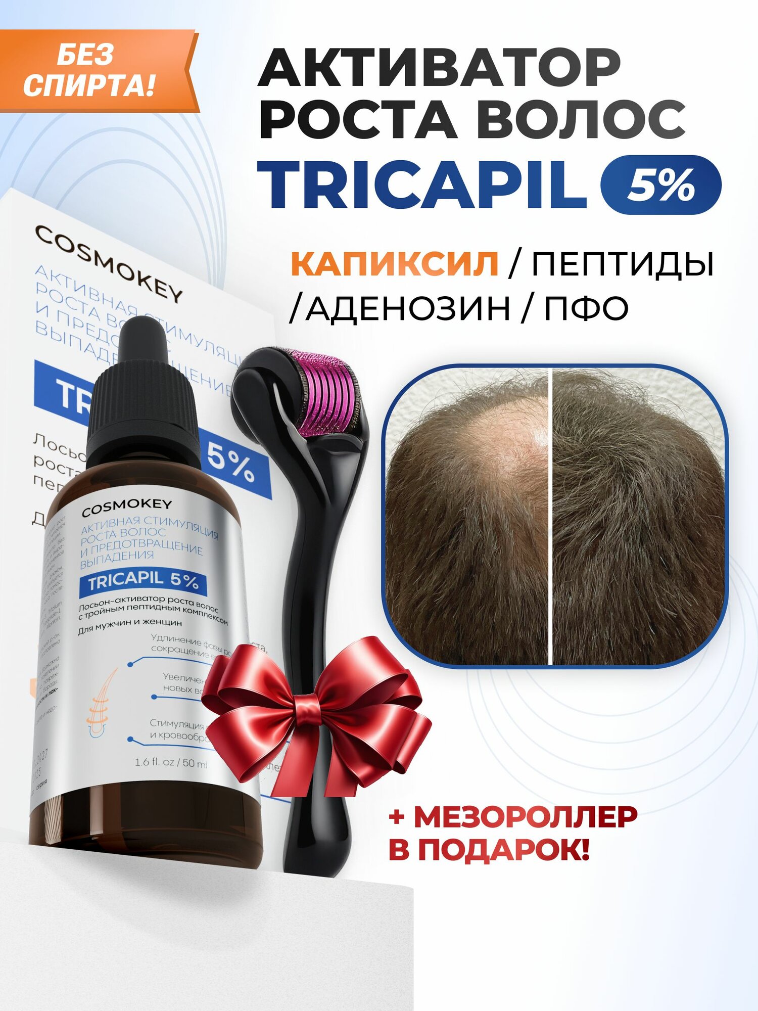 Сыворотка для роста волос Трикапил 5%, от выпадения волос, средство для роста, Капиксил 50 мл + Мезороллер