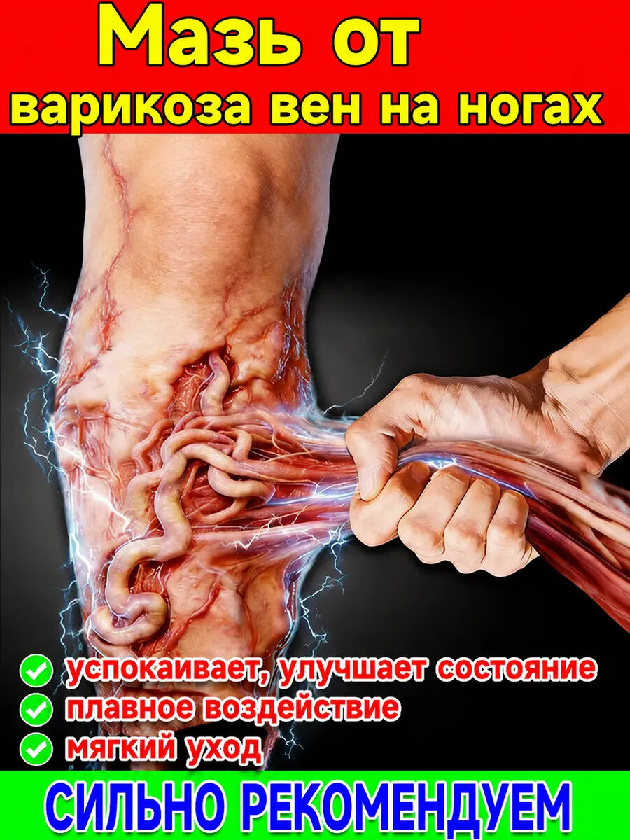 Бальзам дымок китайский от варикоза для ног 50g ，Подходит для всех типов кожи