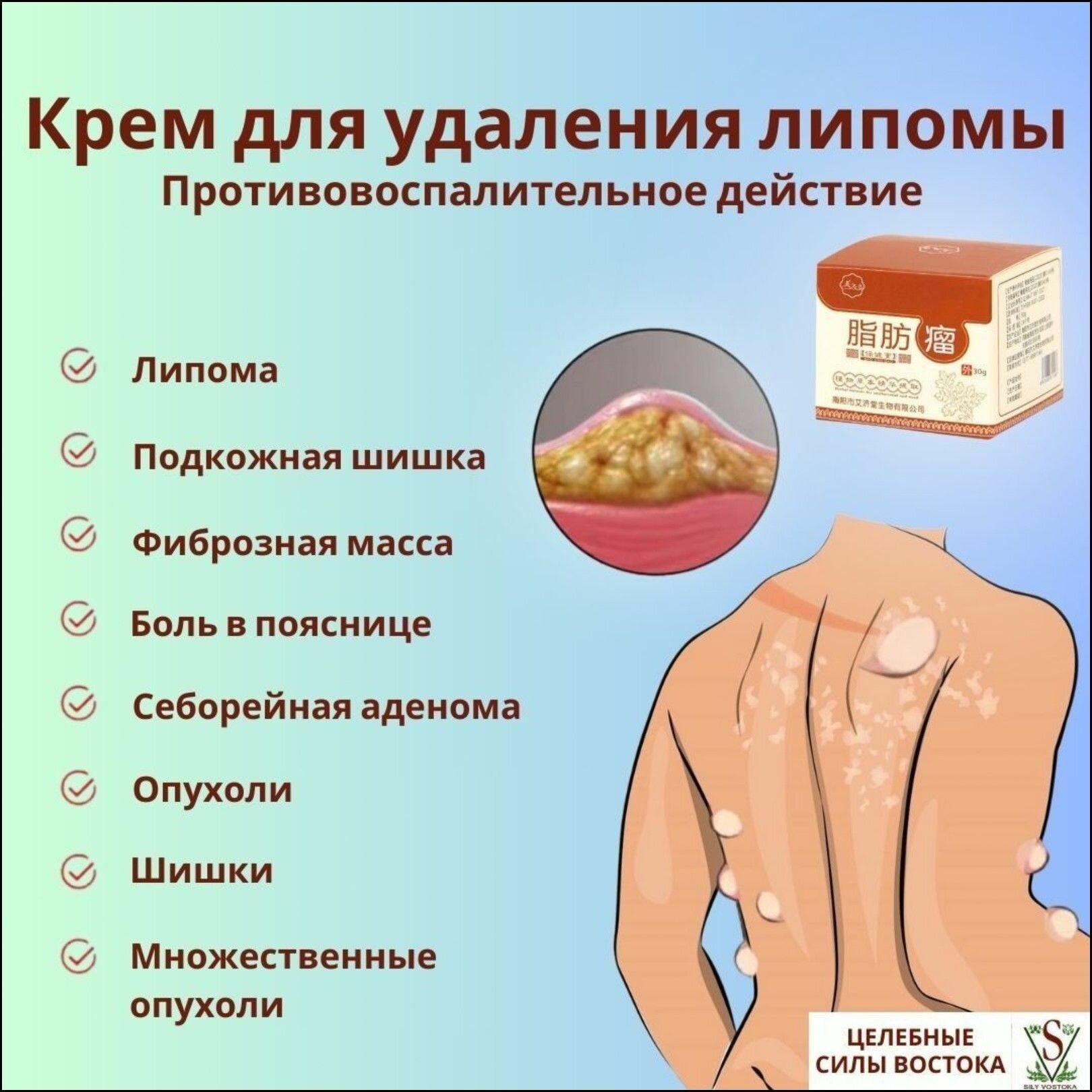 Крем от липомы и жировиков (30 г) - Травяная формула