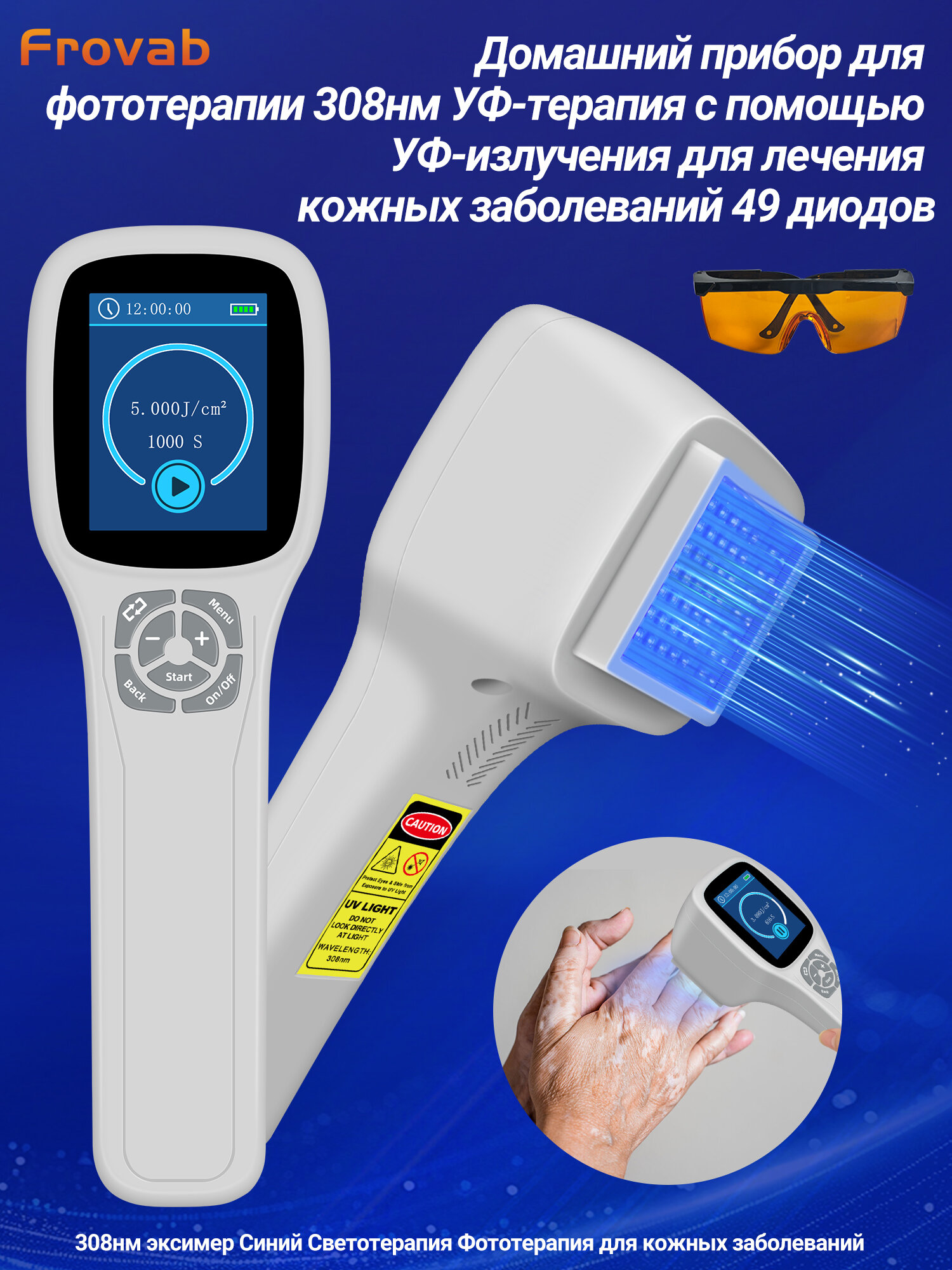 Портативное устройство Frovab 308нм, 49 светодиода, для домашней терапии витилиго, псориаза, экземы и кожных проблем