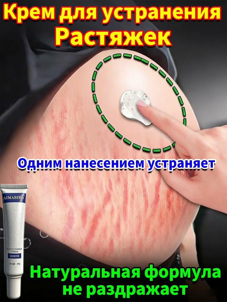 Крем от растяжек 20 г удаляет растяжки, восстанавливает упругость кожи, для тела, груди, ягодиц, живота росле родов