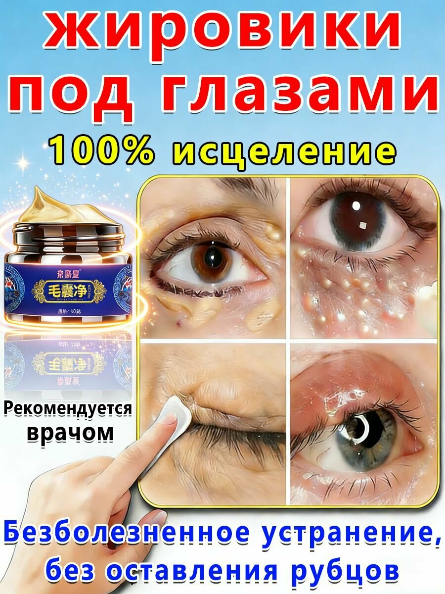 Мазь от жировики под глазами Милиумы Просянка, 30 r