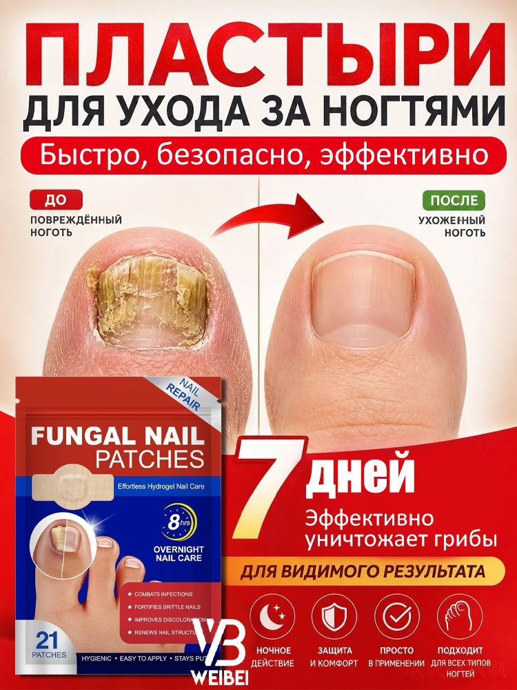 Пластыри от грибка ногтей быстро избавляют от грибковых инфекций рук и ног, а также вылечить утолщение ногтей, покраснение, отек, зуд, расслоение 21шт