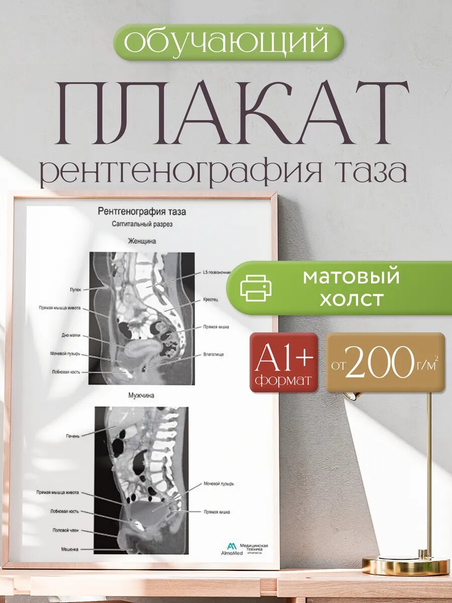 Рентгенография таза, плакат, матовый холст от 200 г/кв. м, размер A1+