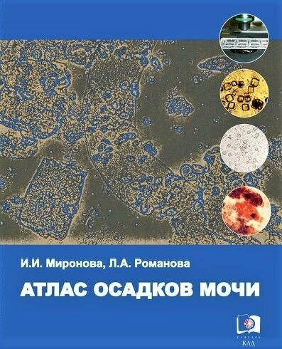Атлас осадков мочи. Миронова И. И.