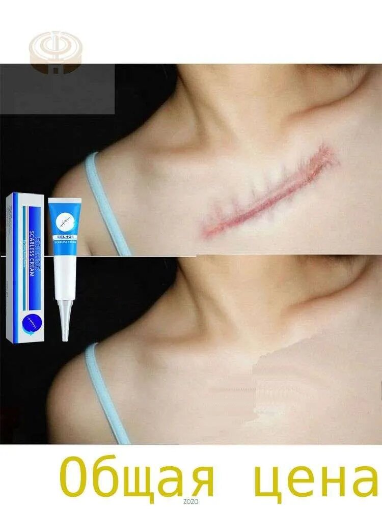 Крем Контрактубекс для восстановления кожи: эффективное средство от шрамов, растяжек и ожогов, нежный уход за кожей.