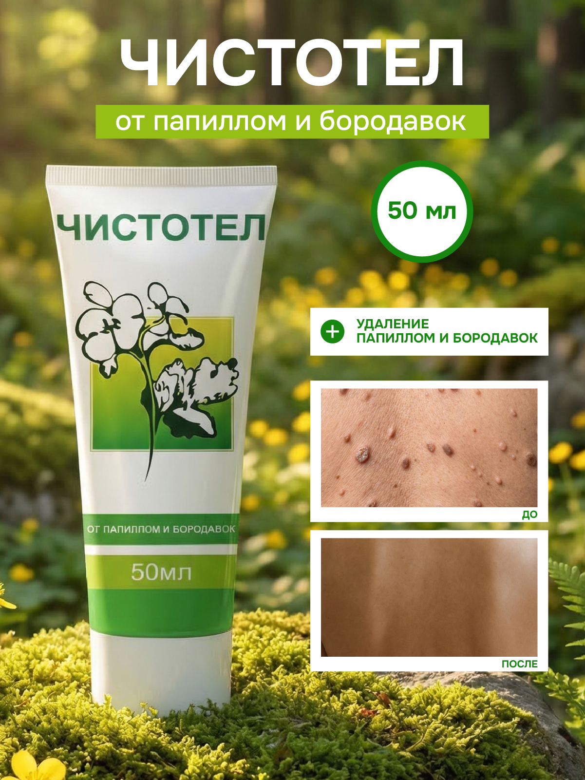 Чистотел, крем для удаления папиллом, сухих мозолей, бережное очищение кожи, туба 50 мл