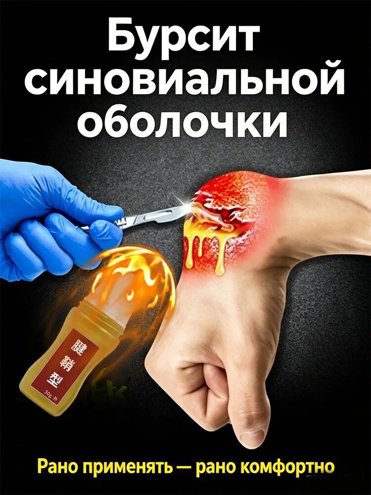 Мазь при гигроме и воспалении сухожилий рассасывание кисты и снятие воспаления