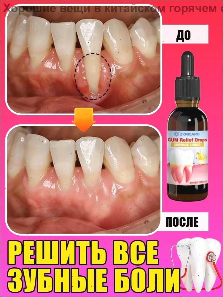 Масло для десен при воспалениях в полости, укрепления дёсен и снижения кровоточивости, Быстро лечит опухшие, лечение пародонтита и гингивита, Чистое дыхание, комплексный уход + защита дёсен,30мл