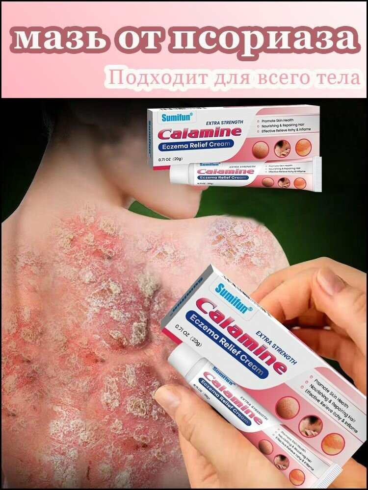 Мазь от псориаза / Крем для ухода за кожей при псориазе, 20 г, экземе и герпесе, акне, ожогах, порезах, от прыщей на лице, укусов насекомых.