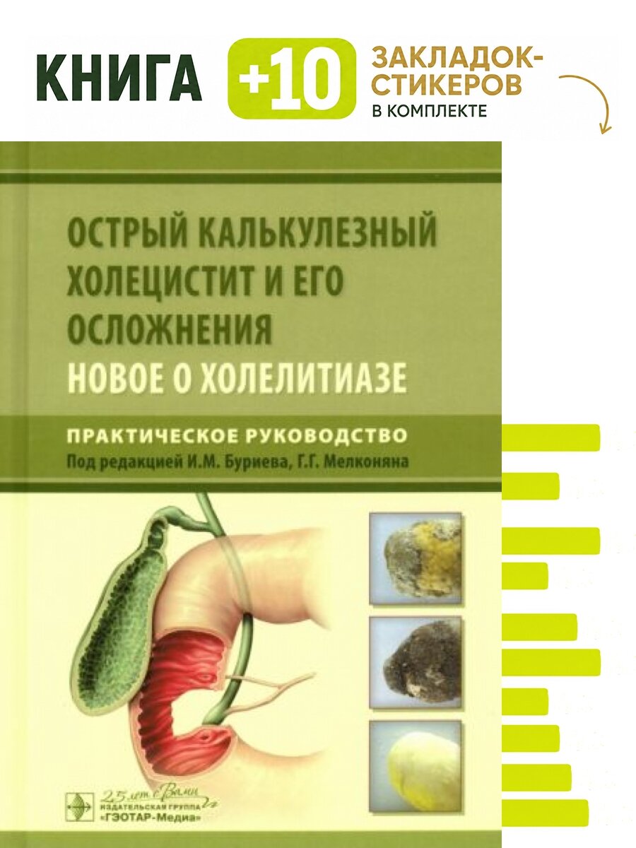 Острый калькулезный холецистит и его осложнения. Новое о холелитиазе. Комплект: книга + 10 закладок-стикеров
