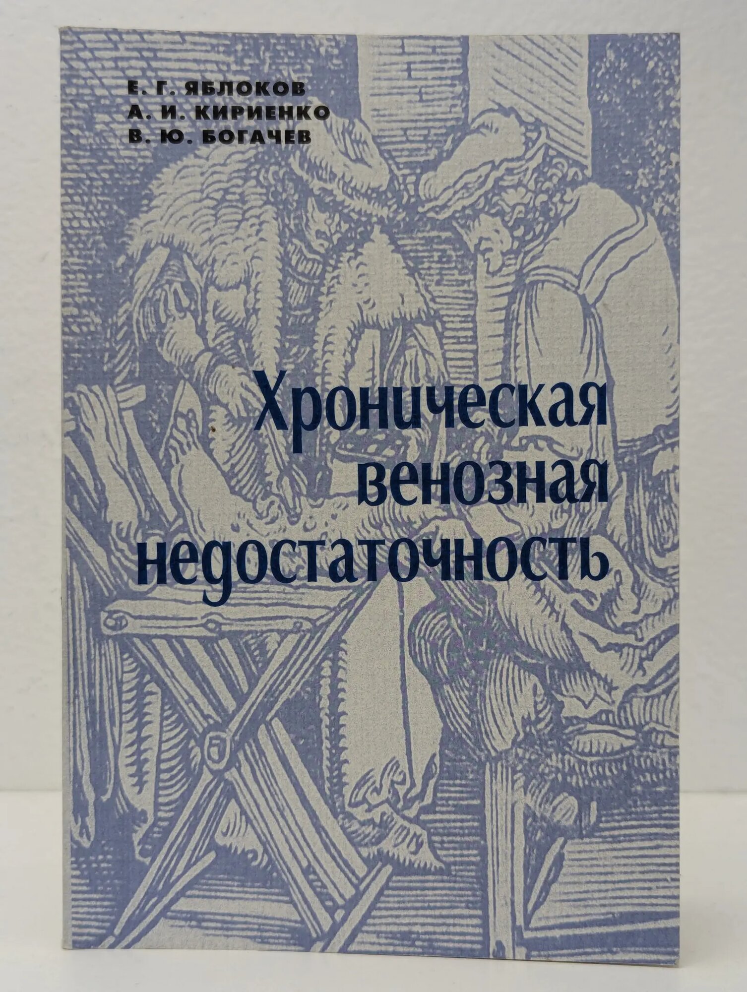 Хроническая венозная недостаточность Яблоков Евгений Георгиевич, Кириенко Александр Иванович, Богачев Вадим Юрьевич 1999