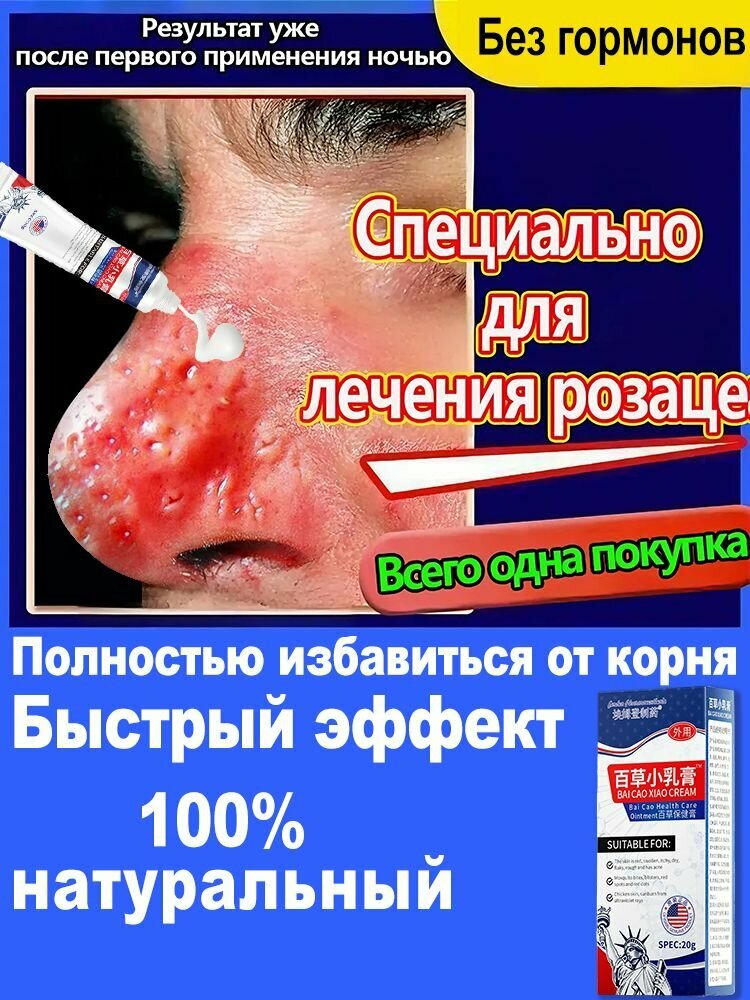 Мазь от розацеа на лице купероза и покраснений