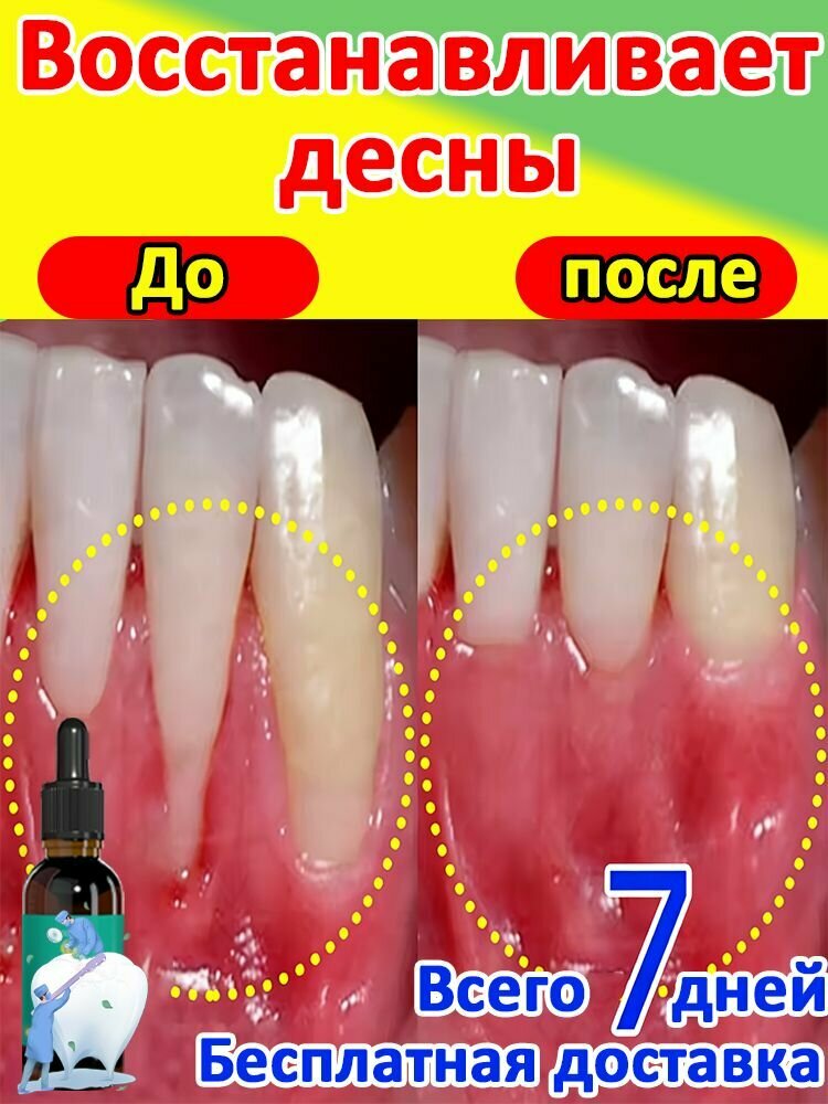Используется для лечения пародонтита, стоматита, снятия чувствительности и отека десен, восстановления, профилактики и укрепления поврежденных десен, Гигиена полости рта, 30 мл, 1 флакон