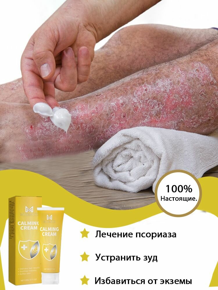 DODOYURI Крем от зуда mазь от псориаза и экземы, эффективное средство от грибка кожи, ногтей на ногах и руках 20 г