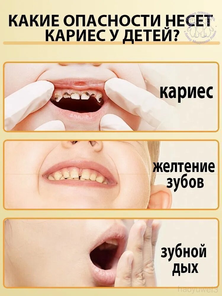 Зубная паста детская со вкусом апельсина для детей 3-6 лет, 180 мл, для чувствительных молочных зубов — фото 1