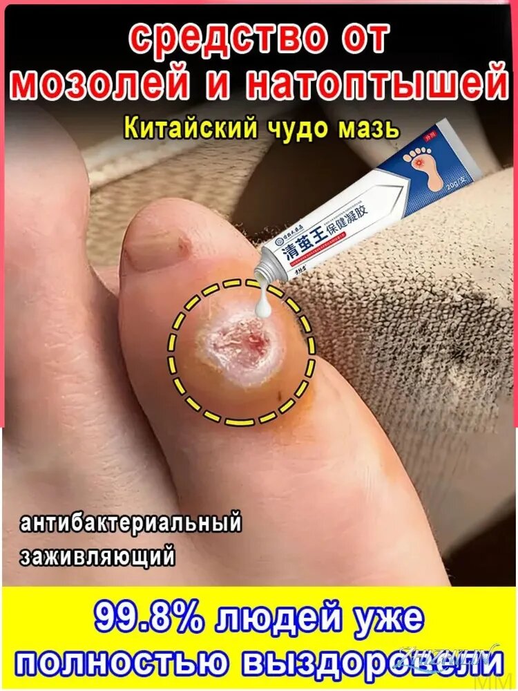 Пластырь от мозолей, стержневых натоптышей и бородавок 20 г Китайский чудо мазь