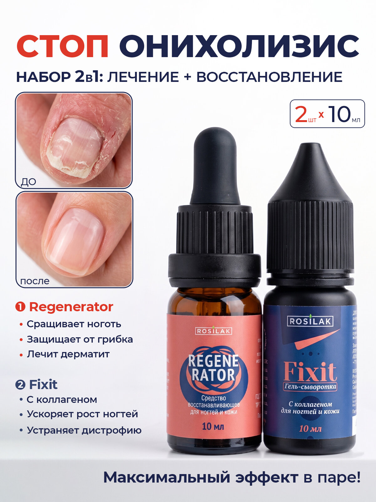Rosilak, набор №18 гель-сыворотка для ногтей и кожи и регенератор от онихолизиса (2 шт по 10 мл)