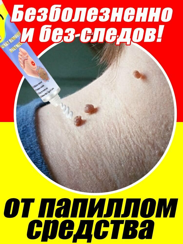 Крем для безболезненного устранения плоских и нитевидных бородавок, папиллом, остроконечных кондилом, родинок и подошвенных бородавок ,100г