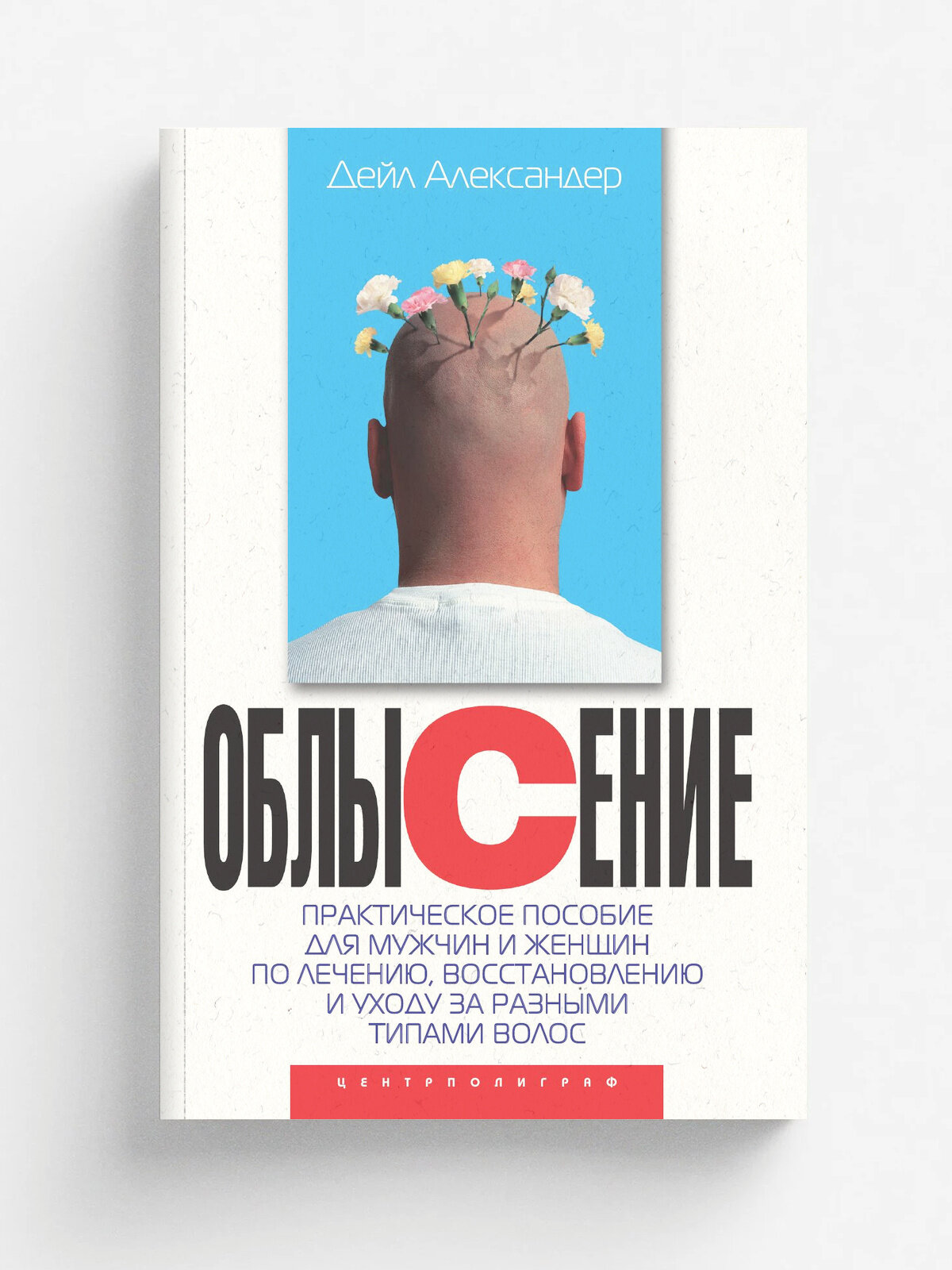 Облысение