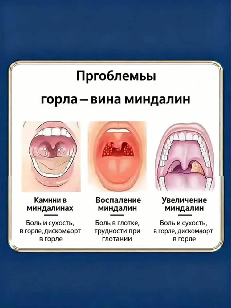 Спрей для полости рта — фото 1