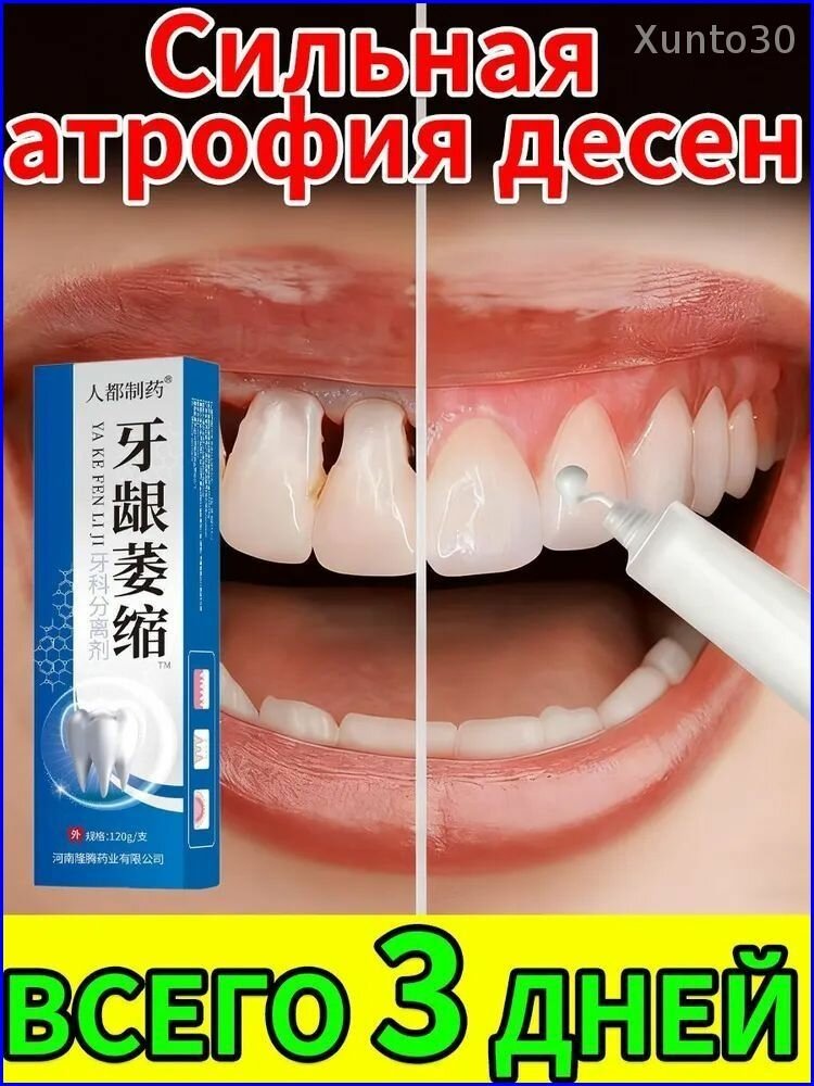 Зубная паста для рецессия десны Для укрепления и восстановления зубов, десен и эмали, от воспаления и кровоточивости десен, для удаления налета