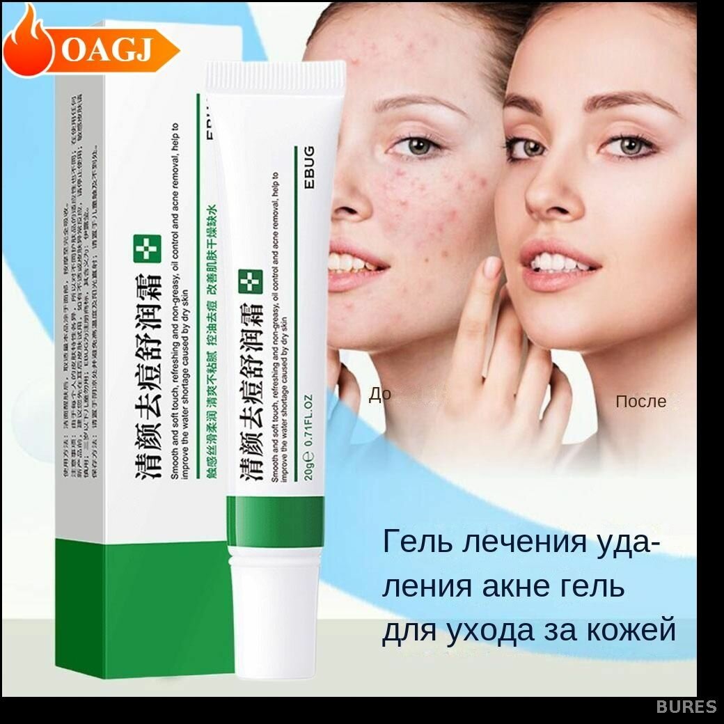 20 г очищающего крема против прыщей, сужает поры и удаляет следы от прыщей.-BURES
