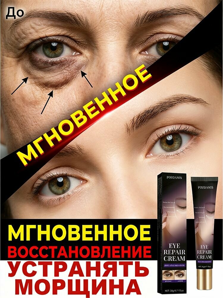 Антивозрастной крем для глаз, эффективно борется с темными кругами и морщинами, быстро устраняет "гусиные лапки", увлажняет и подтягивает кожу, уход за глазами, 20 мл