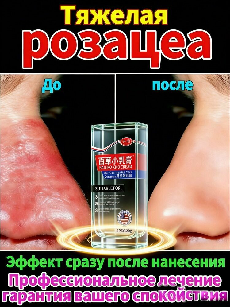 Крем для лечения розацеа и купероза, снимает покраснение и раздражение кожи, уменьшает проявление сосудов, 20 г.