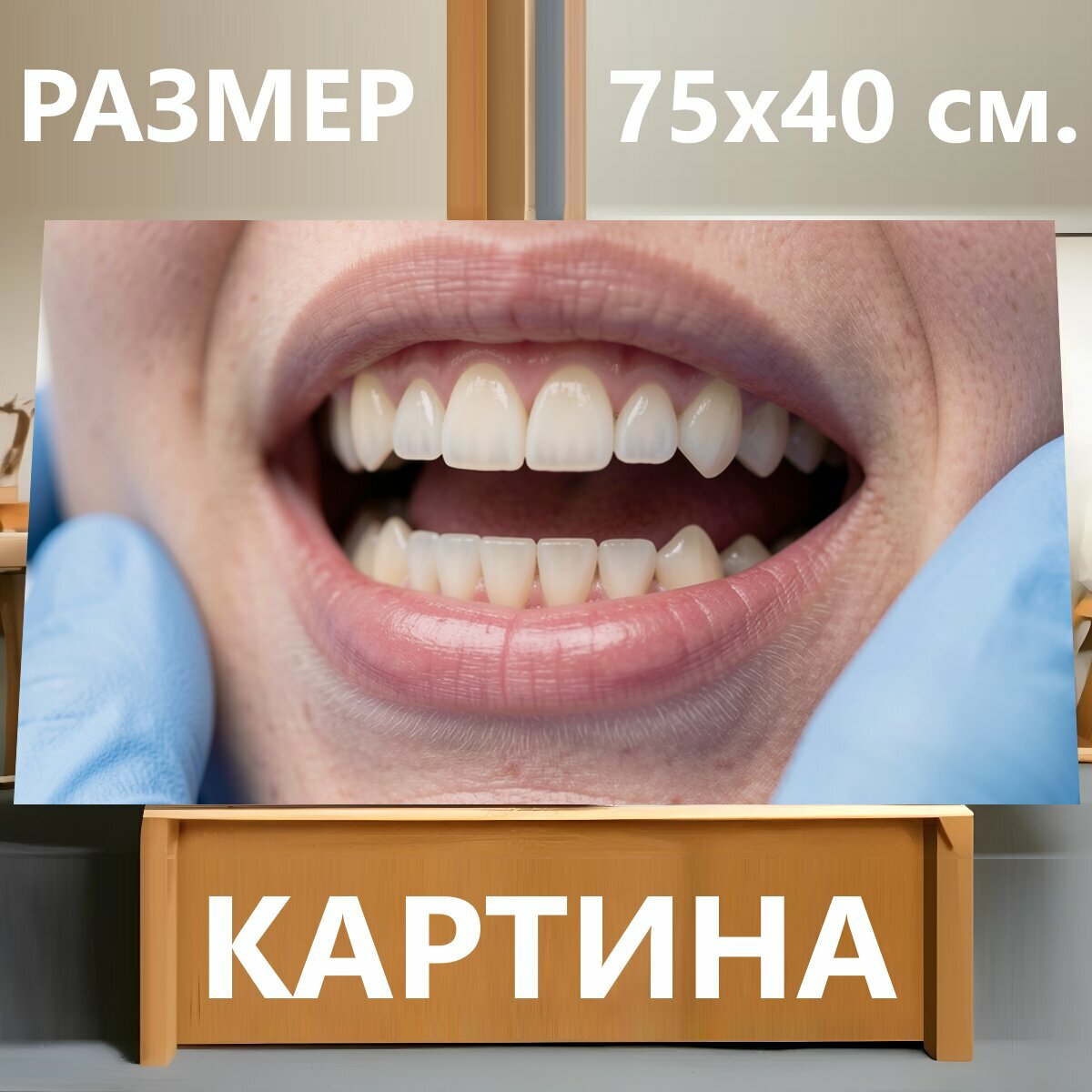 Картина на холсте "Крупный план рта человека с открытыми зубами, стоматолог в синих перчатках, мягкое рассеянное освещение, реалистичный стиль." на подрамнике 75х40 см. для интерьера