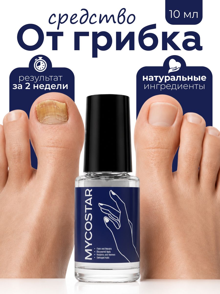 Масло от грибка ногтей, эффективное средство от грибка ногтей на ногах и руках, Costar, стоп онихолизис