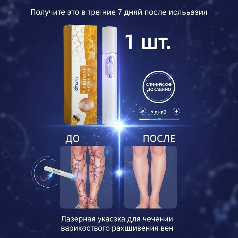 Ximonth Портативный аппарат для лечения варикоза LED-лампой, улучшает кровообращение и снимает боль в ногах