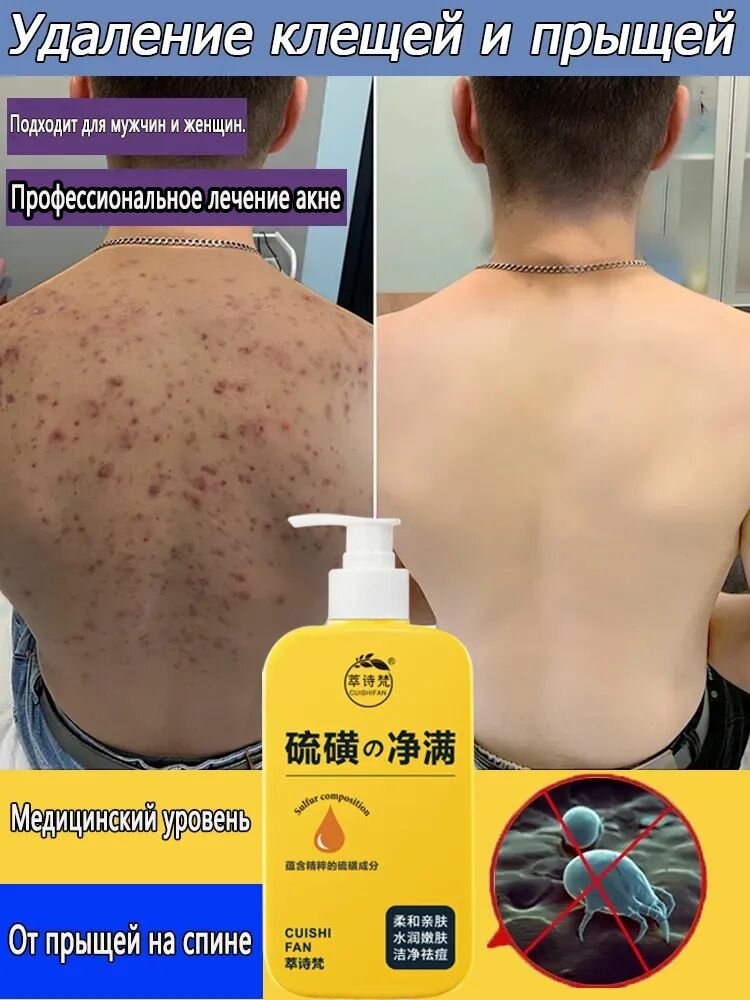 1 шт/300 мл/Серное мыло жидкое для тела натуральное / Глубокое очищение против акне и демодекоза / Для чувствительной кожи