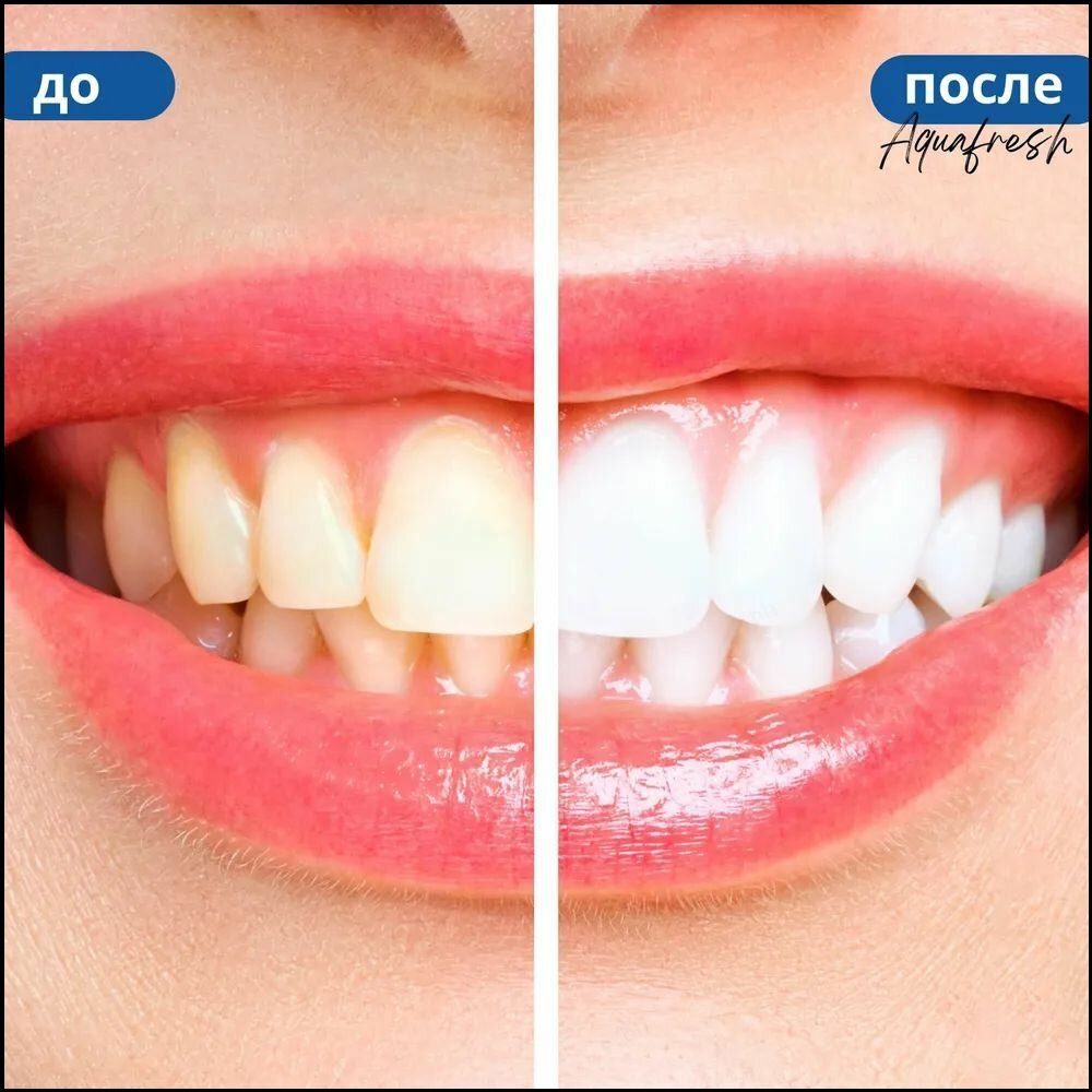 Зубная паста — фото 1