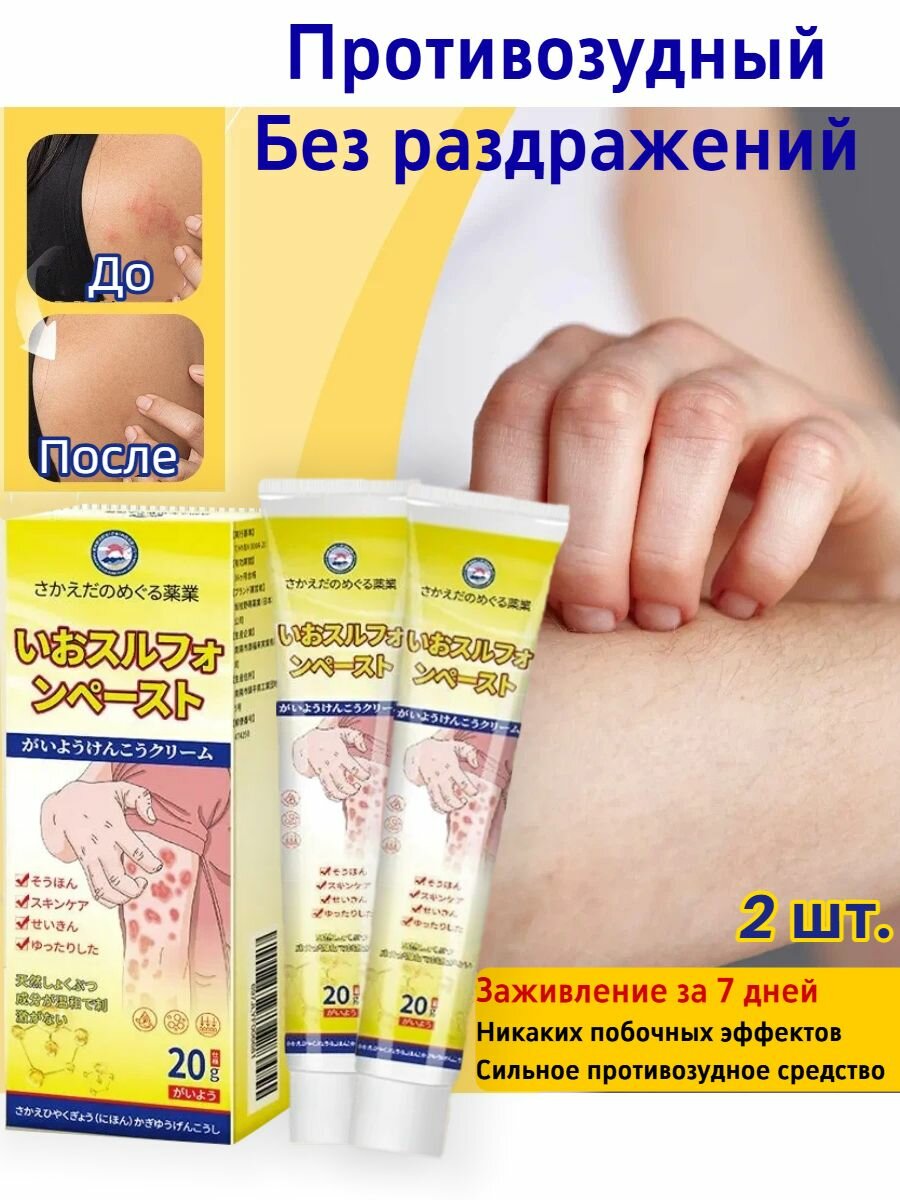 Тело крем от псориаза Противозудное, антибактериальное средство при экземе и герпесе