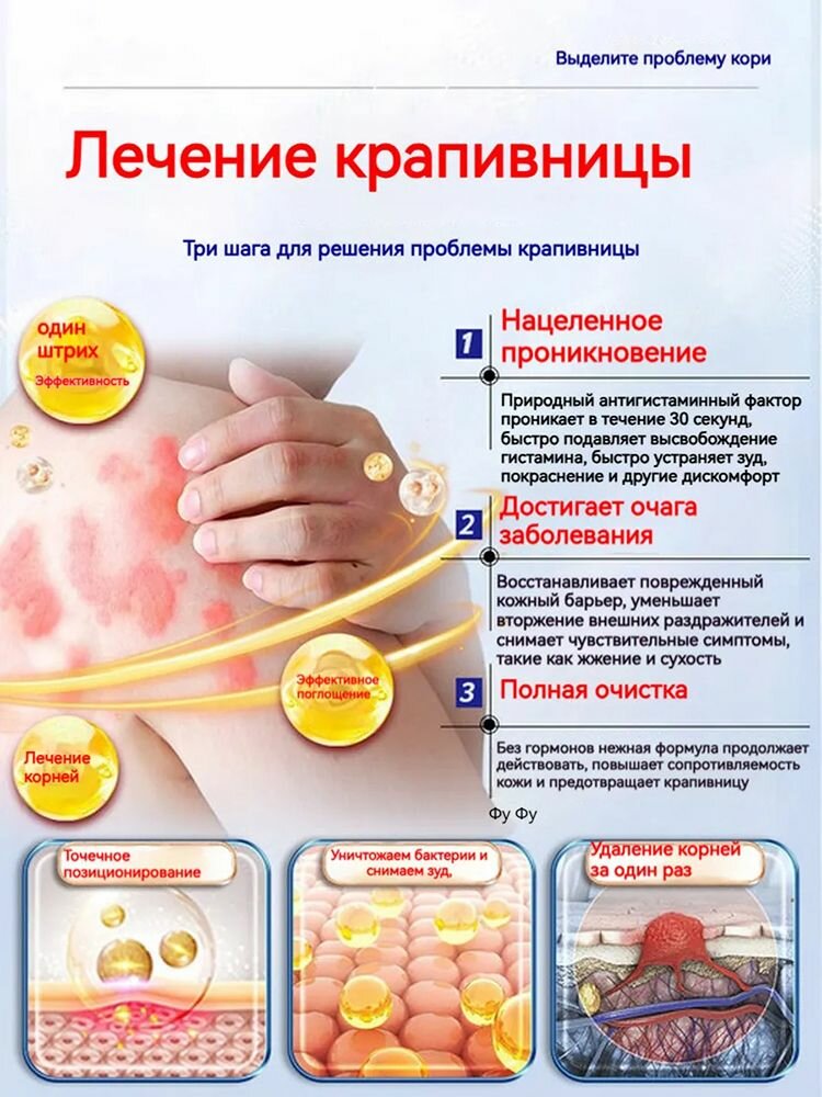 Лосьон лечебный от псориаза, дерматита, экземы, крапивницы натуральный на травах спрей без гормонов
