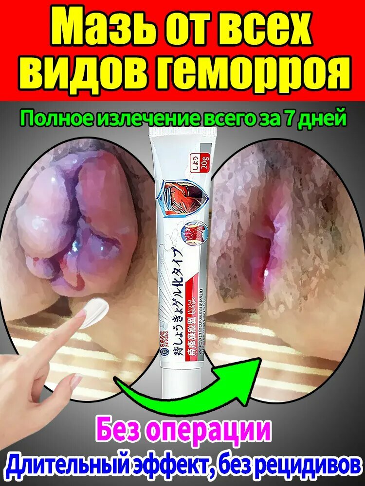 Релиф мазь от геморроя . Китайский чудо-крем 20 г. мускусный крем от геморроя
