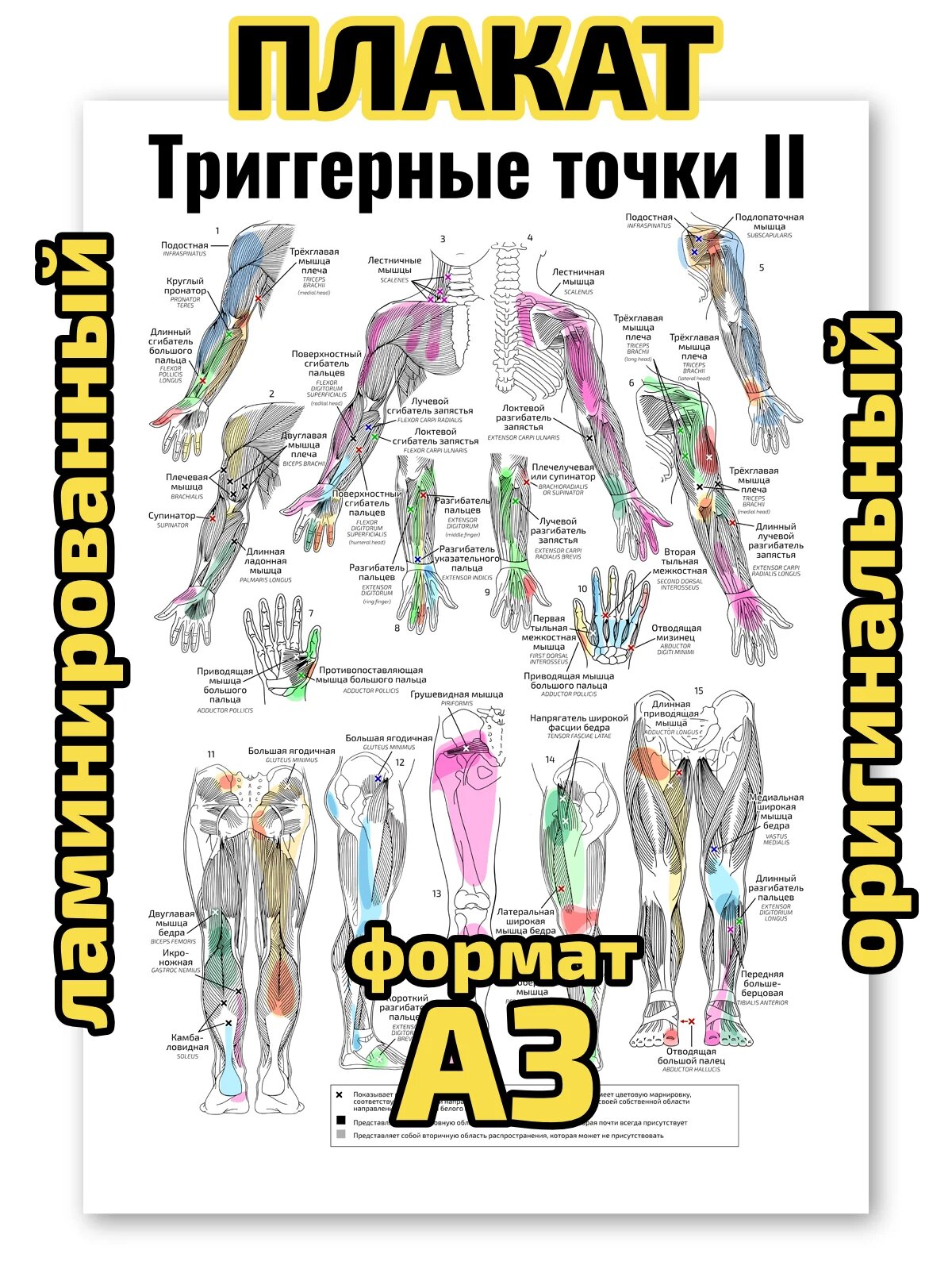 Плакат Квинг "Триггерные точки II", ламинированный, А3, для изучения анатомии и мануальной терапии