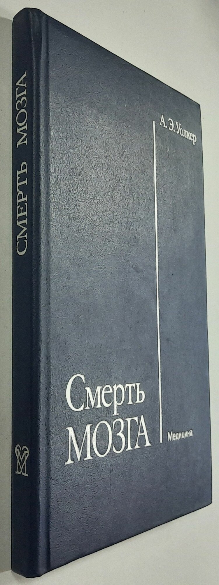 Смерть мозга — фото 1