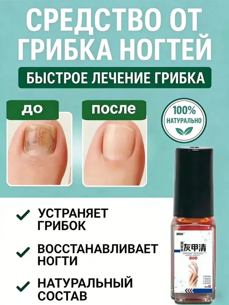 Антибактериальная жидкость против грибка ногтей Эффективное средство от грибка ногтей на ногах 5 мл