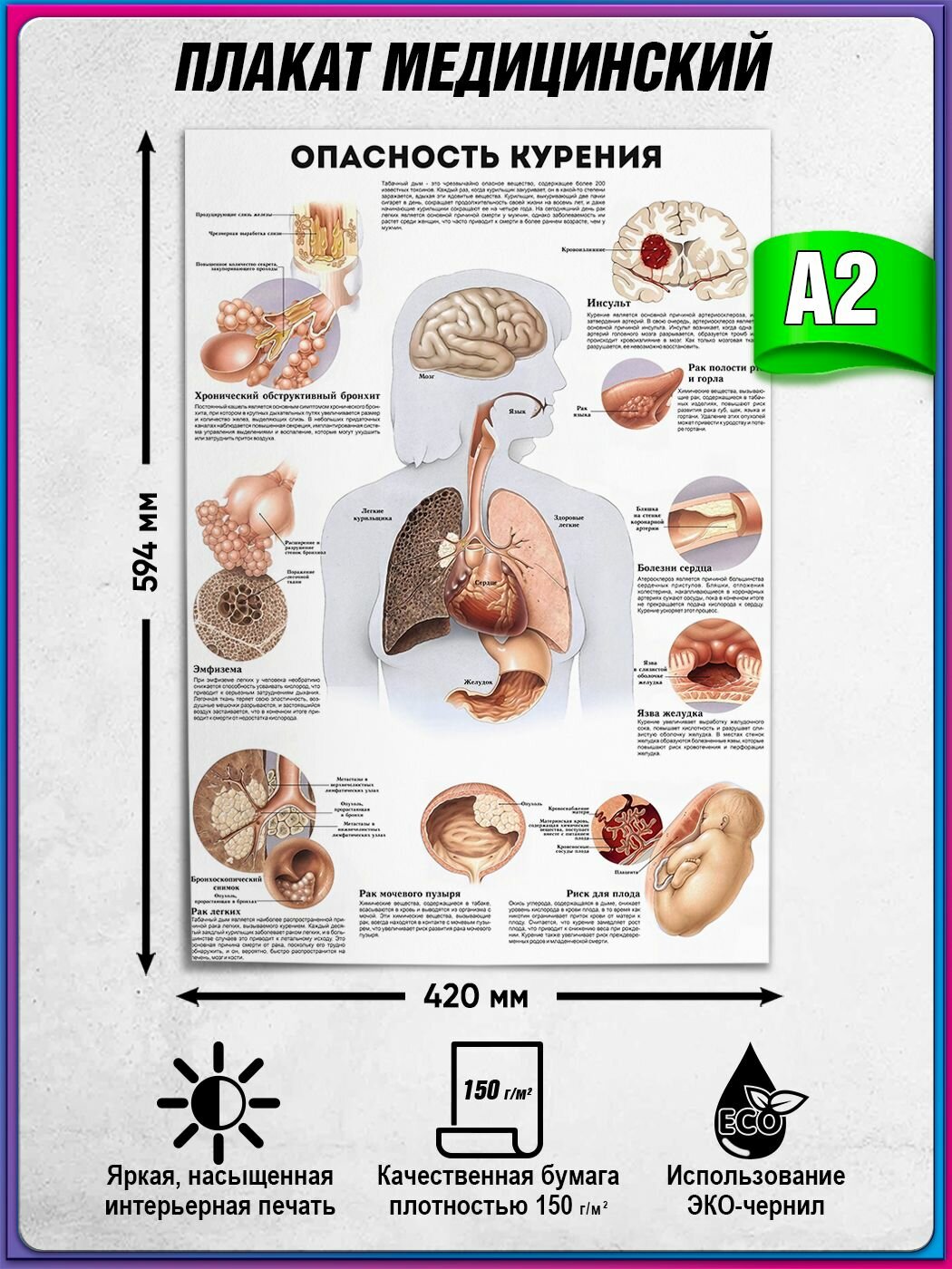 Информационный медицинский плакат "Опасность курения" / Формат А2 (42х60 см.)