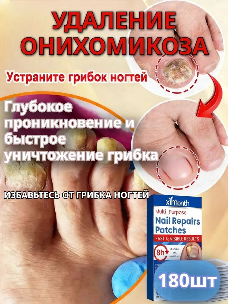 180 шт Пластыри для лечения грибка ногтей на ногах , Используется для Для восстановления поврежденных ногтей на ногах