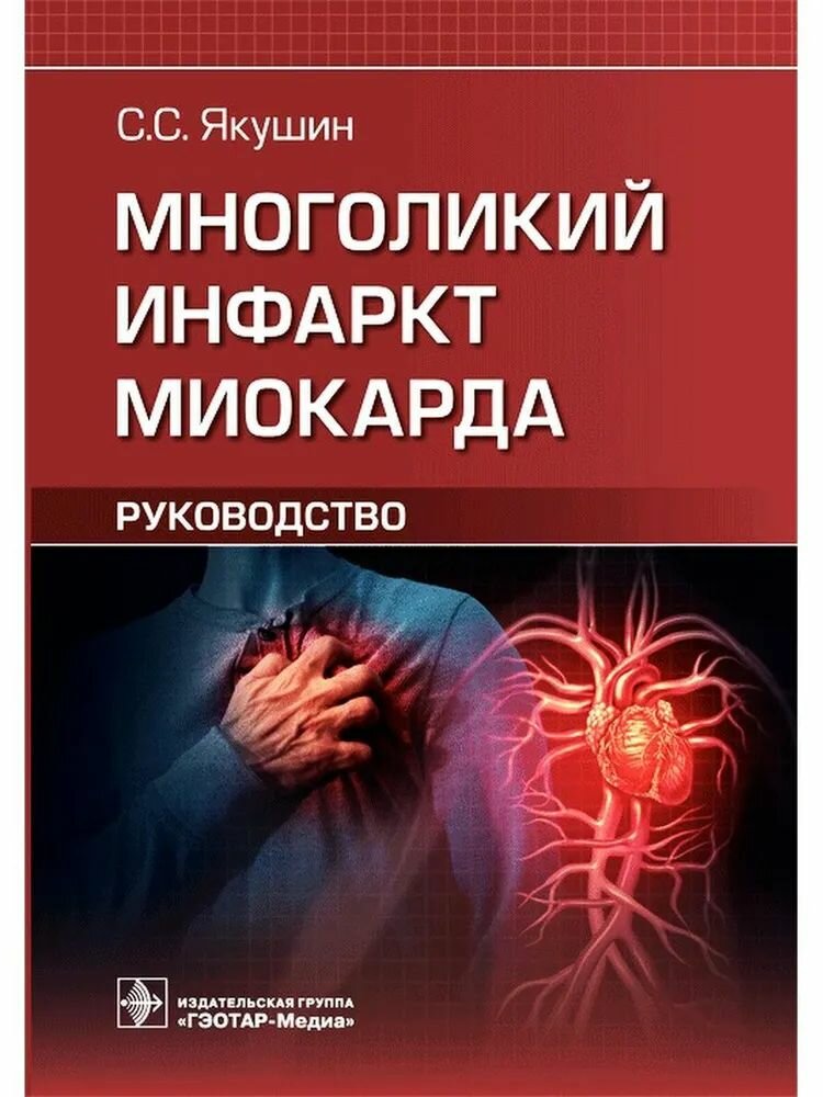 Многоликий инфаркт миокарда. Якушин С. С.