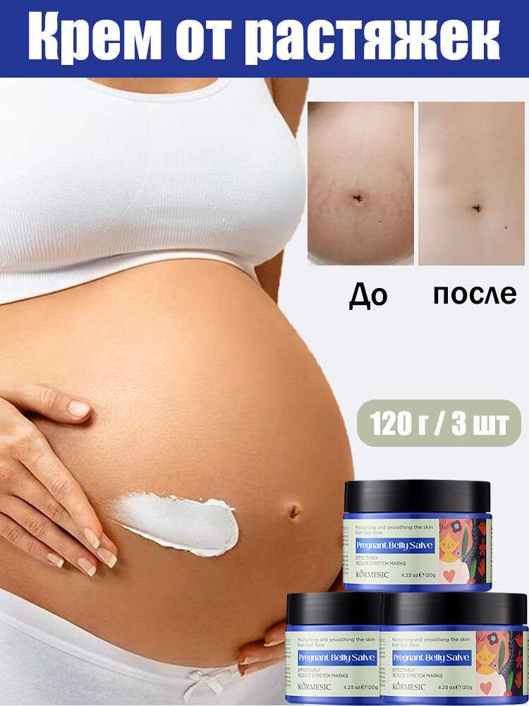 Крем от растяжек для беременных, для тела для профилактики растяжек при беременности и после родов, увлажняет и питает кожу, восстанавливает эластичность кожи,120г/3 шт.