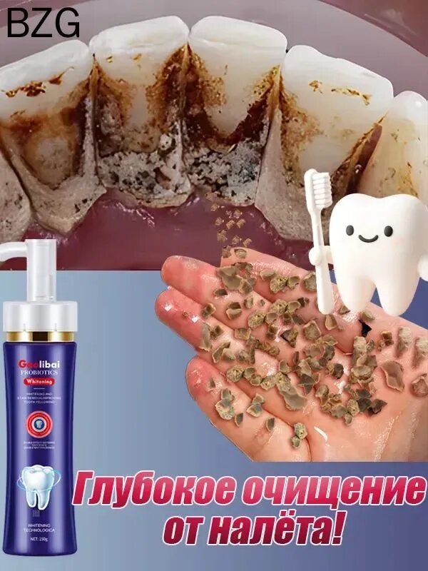 Отбеливающая зубная паста, Термолитический лизоцим, Очистите пятна на зубах, для чувствительных зубов, защищает от кариеса, против зубного налета, ежедневный уход, 150 мл
