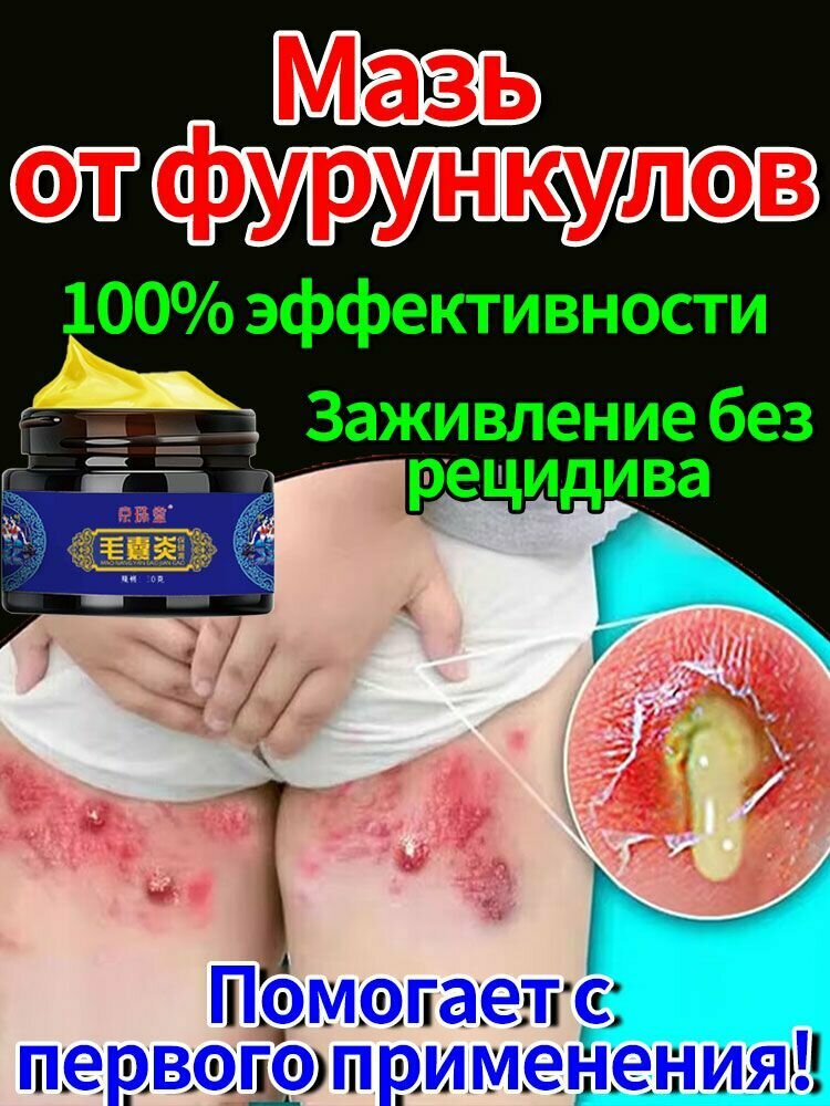 Мазь от глубокиих гнойников и абсцессов, быстро прорывает, вытягивает гной, снимает боль 30г