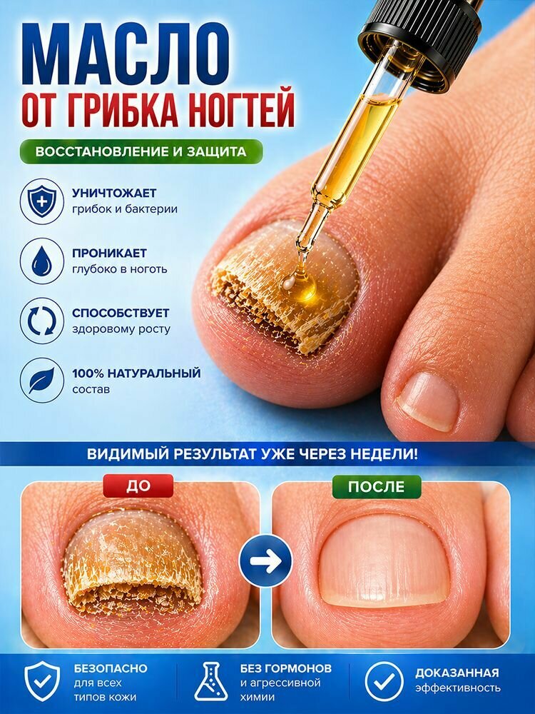 Масло для лечения грибка ногтей, улучшающее состояние ногтей и восстанавливающее пожелтевшие и поврежденные ногти.