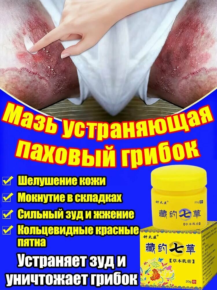 Мазь от зуда, красных пятен и шелушения в паху и на ягодицах